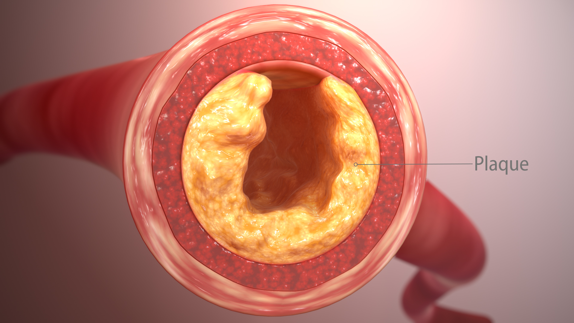 Myths And Facts About Cholesterol You Should Know Myths And Facts About Cholesterol You Should Know