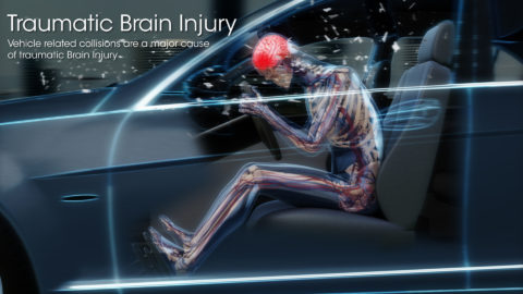 Traumatic Brain - Scientific Animations