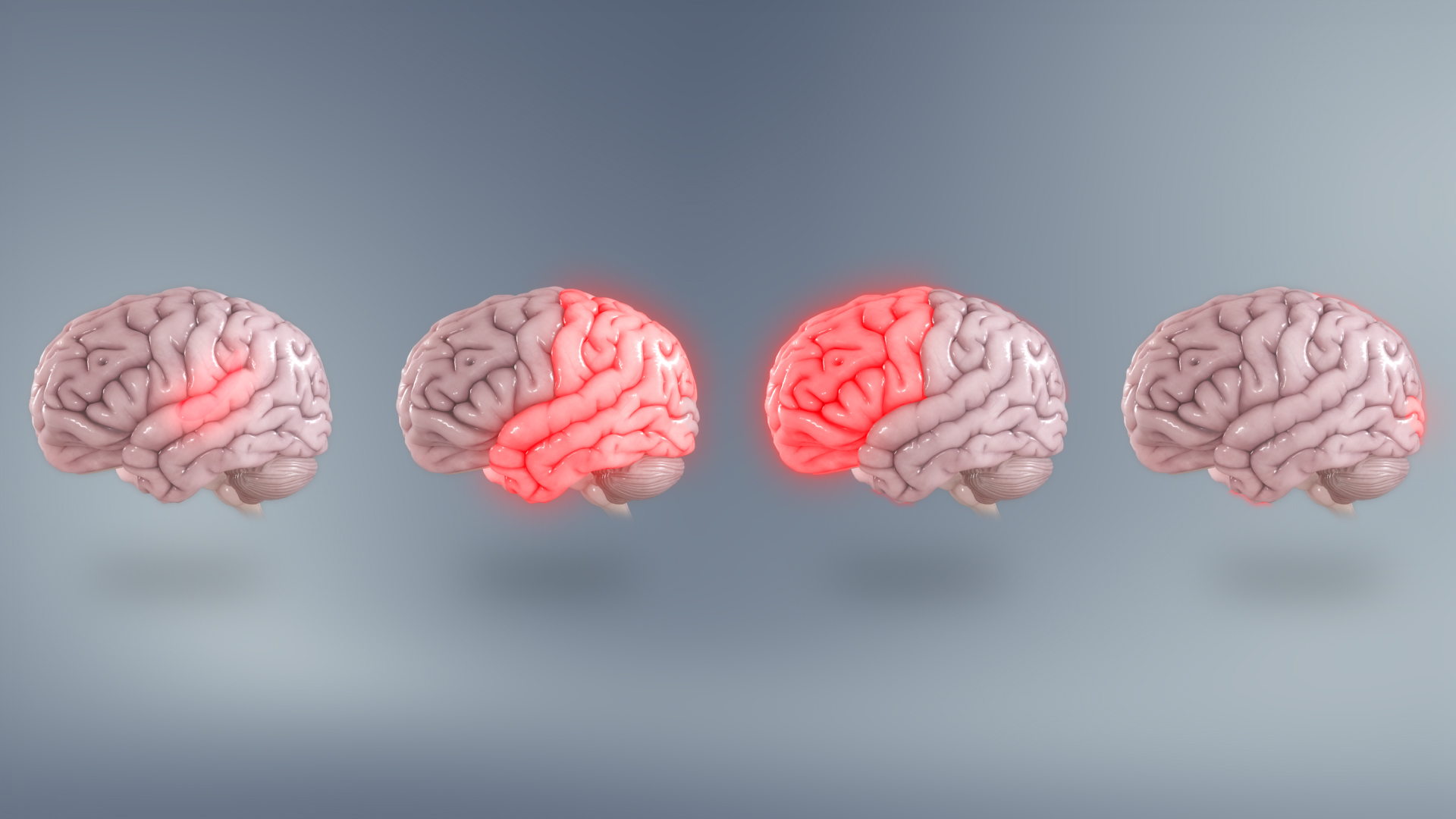 Alzheimer’s disease - Scientific Animations