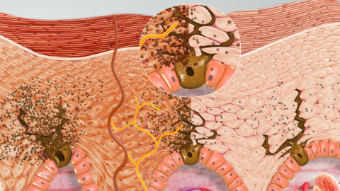 The Chemistry of Skin Tanning - Scientific Animations