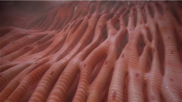 B78- Heart Failure Implanted Device CCM Therapy - Scientific Animations